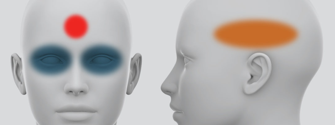 Cefalea en racimos: qué es, causas, síntomas, tratamiento ...