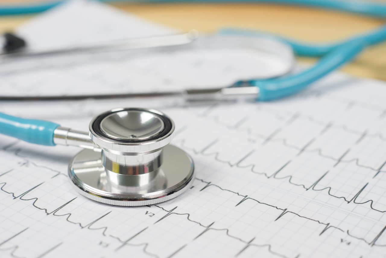 La cefalea cardíaca como indicador de infarto de miocardio ...